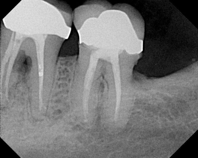 Septic Tank Teeth (abridged) - IABDM